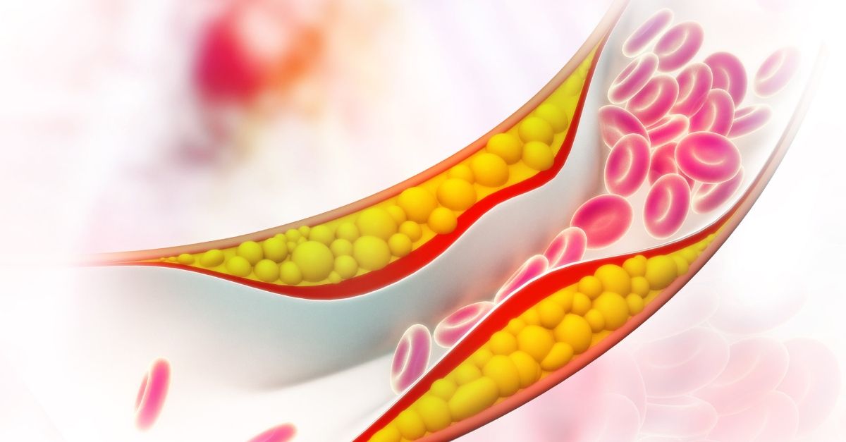 Cholesterol a jak na něj díky Schüsslerovým solím