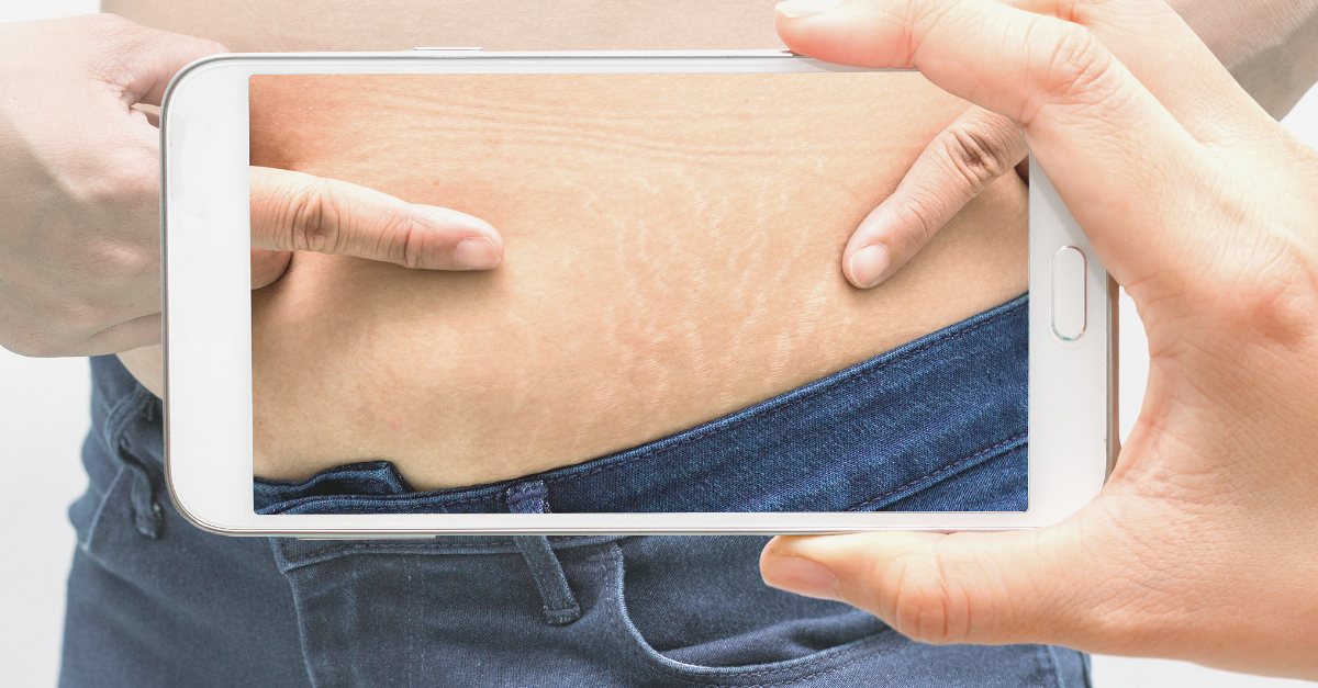 Žila jsem dlouho v obrovské vině a ony to byly pouhé strie ~ Homeoporadna